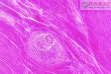 Trikiner - Sidor [1] - World uppslagsverk kunskap